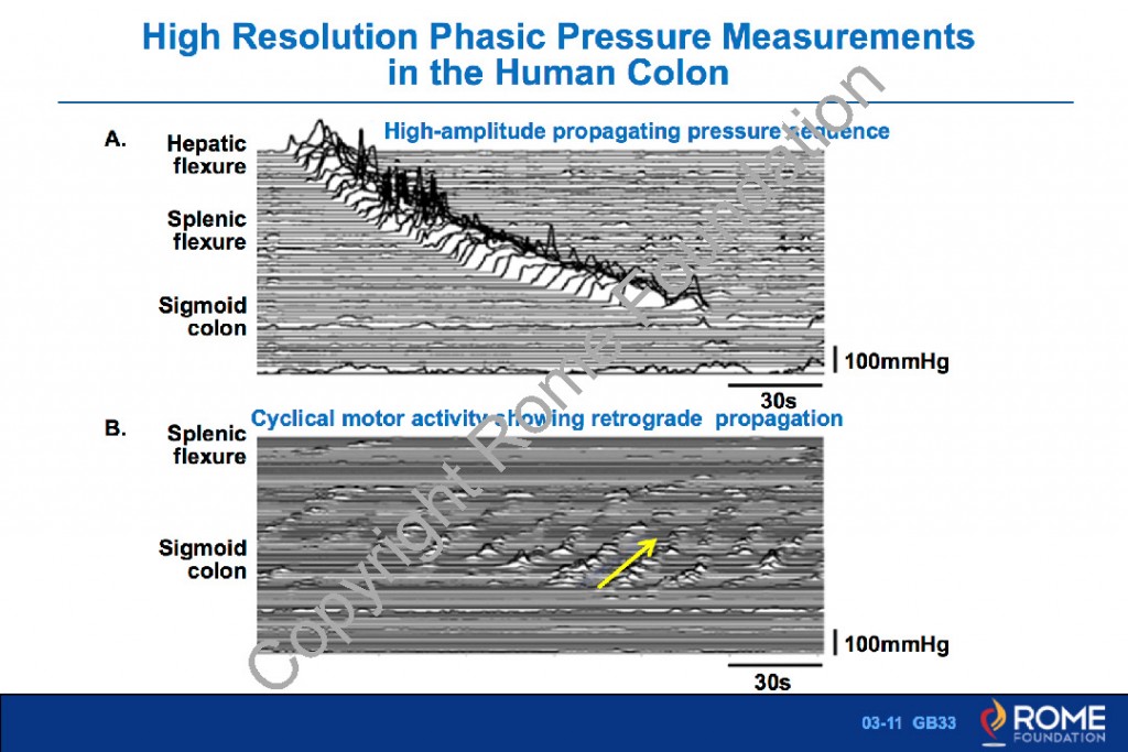 Physiology Motility 18 – Gastrointestinal Motility and ENS-CNS Control ...