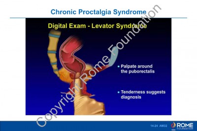 Anorectal 13 – Rectocele – Rome Online